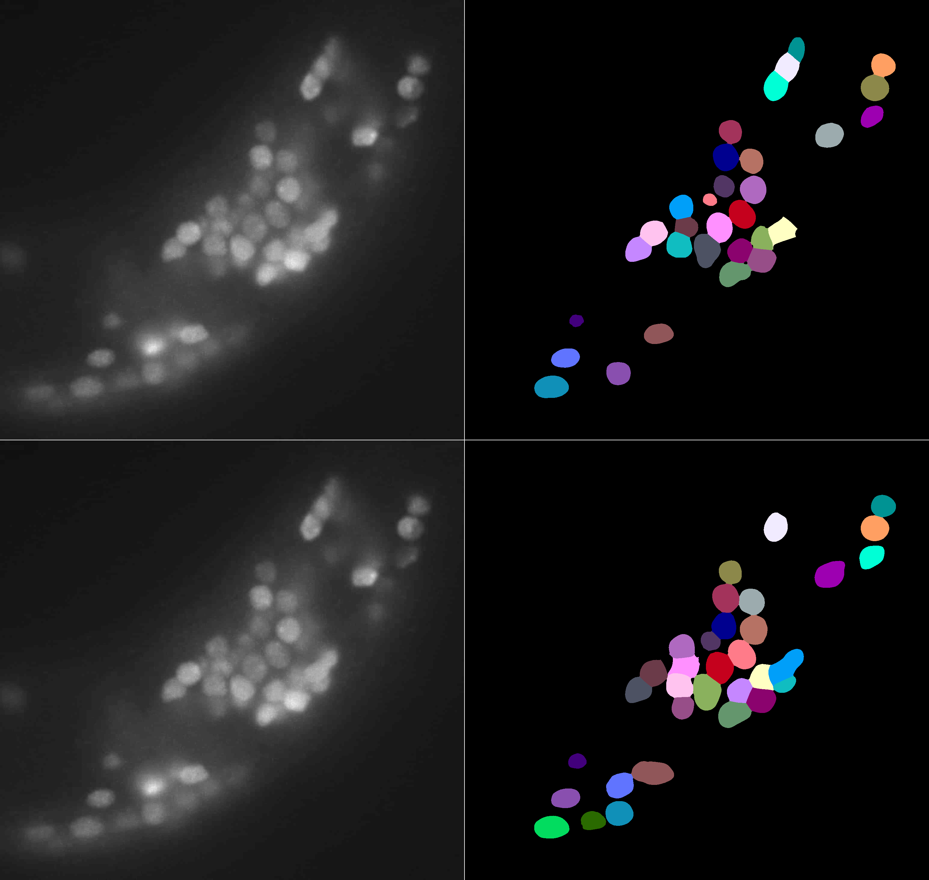 Efficient segmentation of densely packed nuclei in 3D CellPose - Usage & Issues - Image.sc Forum