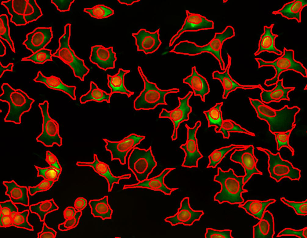 Combining Cellpose and StarDist detections into cells - Image Analysis - Image.sc Forum