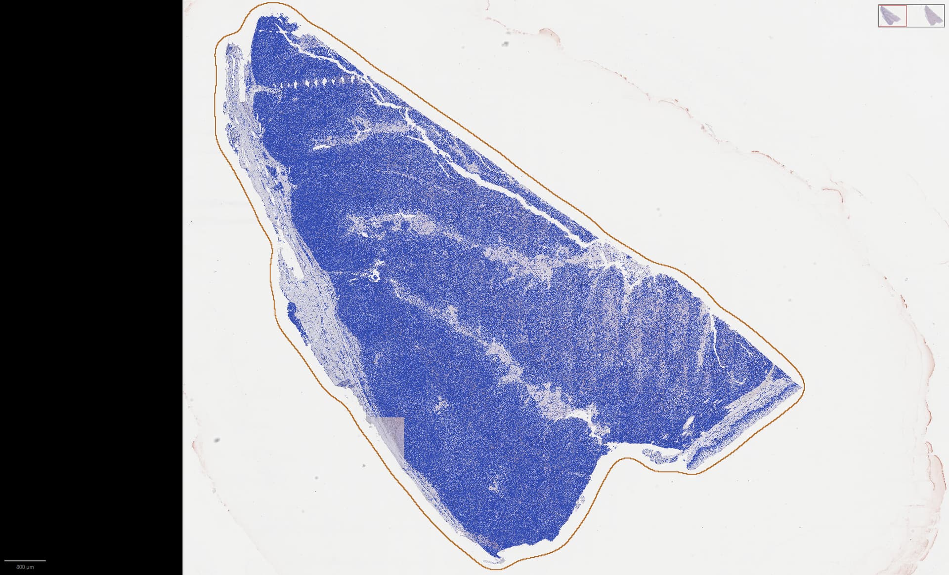 Cellpose Extension In Qupath Cannot Get Deconvolution And Normalization Working Together