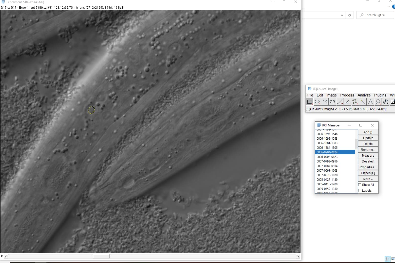 Identify nucleolus in DIC/brightfield using deep learning - Image ...
