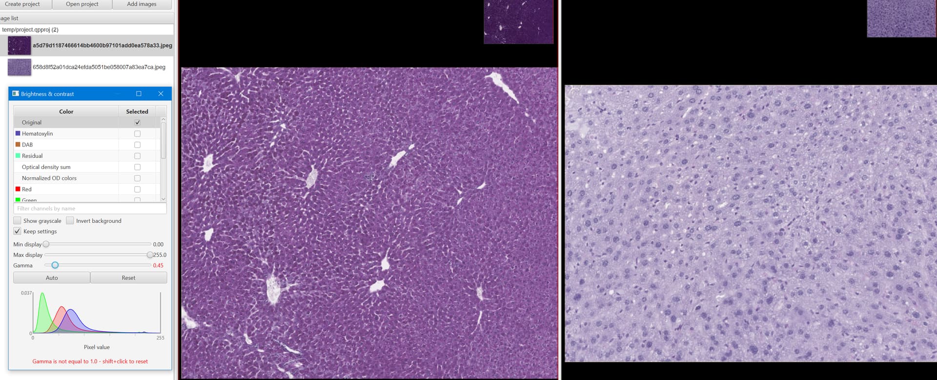 Aid In Analysis Of Pas Stained Slides Using Qupath Image Analysis Imagesc Forum