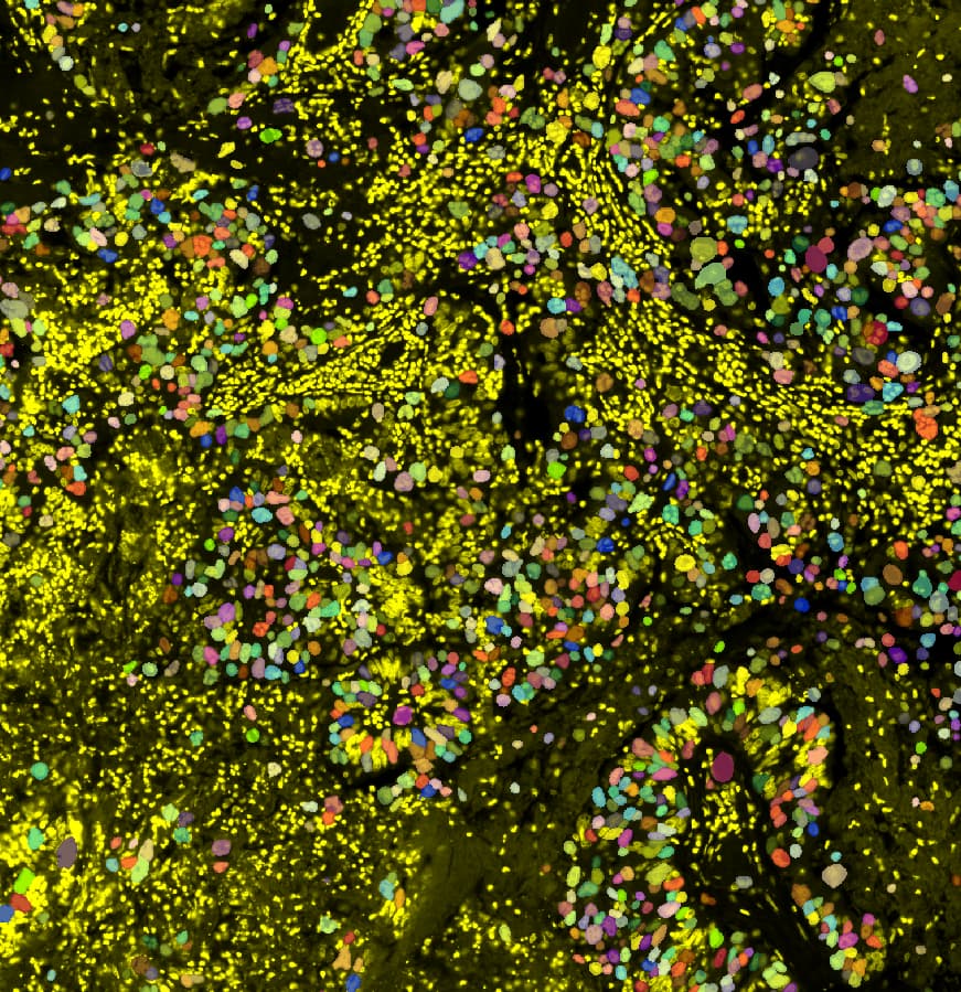 Mcmicro Cellpose Result Usage And Issues Image Sc Forum