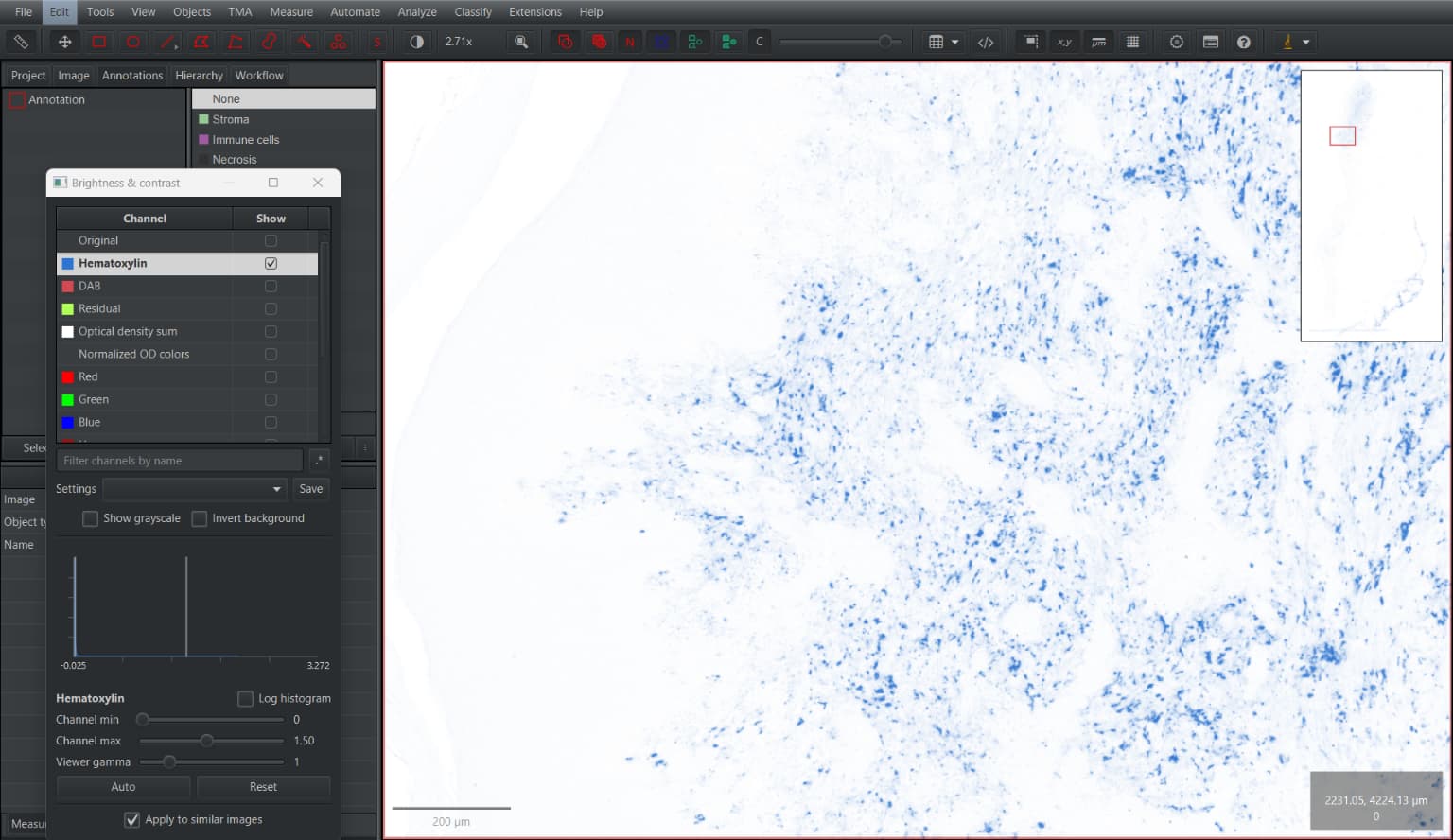 ᴗ•)/ QuPath scripting (#6): Customized 3 stain color deconvolution - Usage & Issues - Image.sc Forum