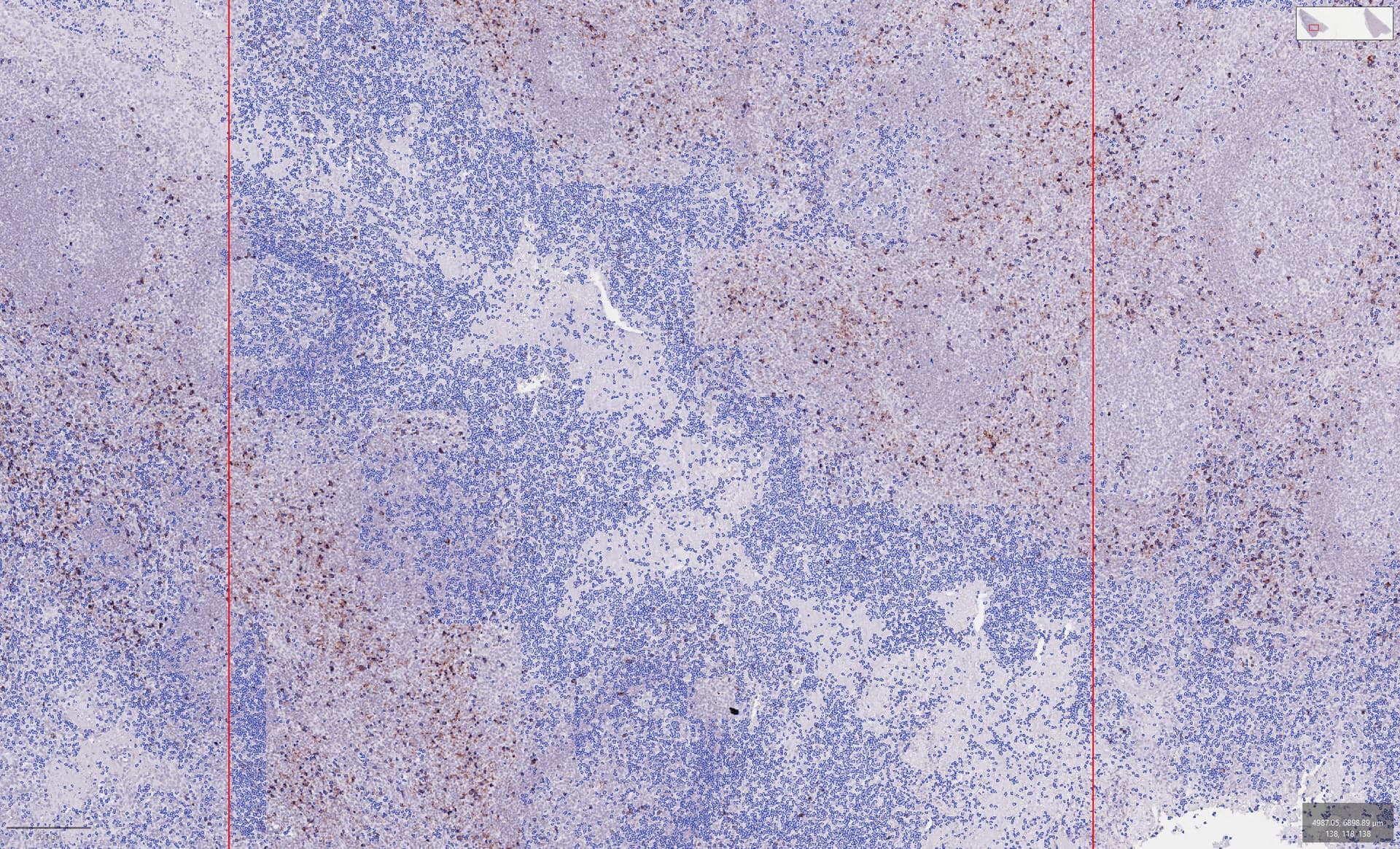 Cellpose Extension In Qupath - Cannot get deconvolution and normalization working together ...