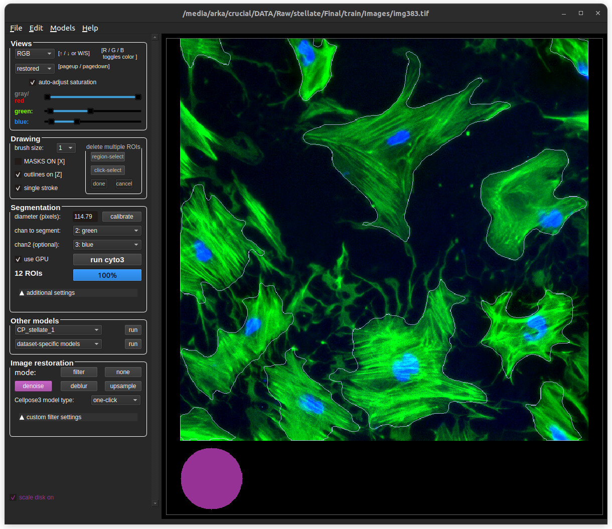 Challenging Segmentation With Cellpose Need Help Image Analysis Image Sc Forum