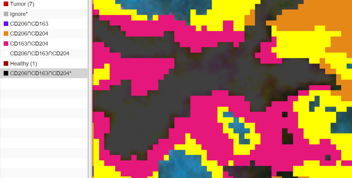 In a QuPath overlay, can you hide or show individual pixel classes? - Usage & Issues - Image.sc ...