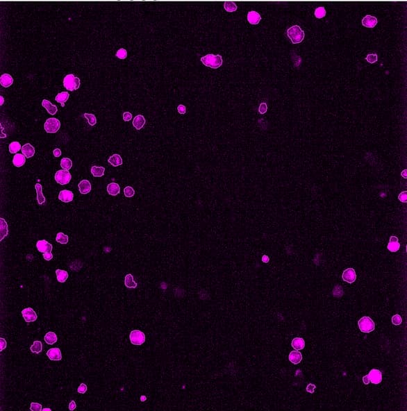 Issues with Trackmate-Weka for 3D tracking - Usage & Issues - Image.sc Forum
