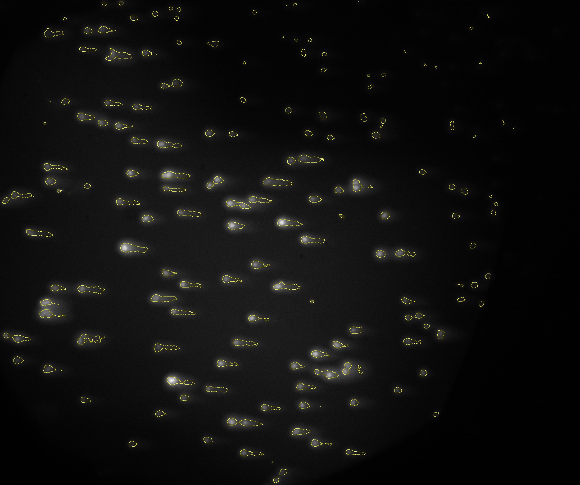 Comet Segmentation on uneven background - Image Analysis - Image.sc Forum