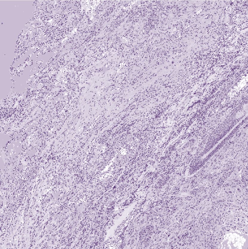 Exporting Color Deconvolved Tiles As They Appear In Qupath Image Analysis Imagesc Forum