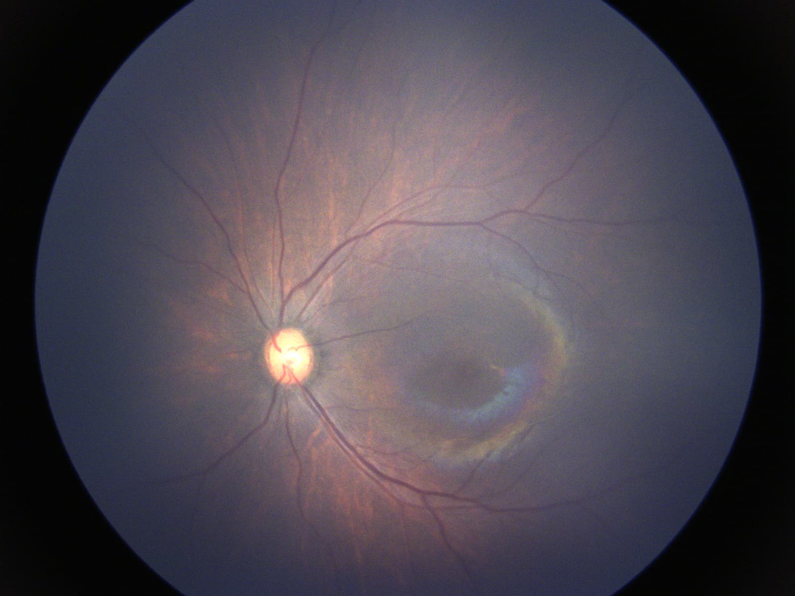 How to identify arteries and veins in retina using Fiji - Image ...