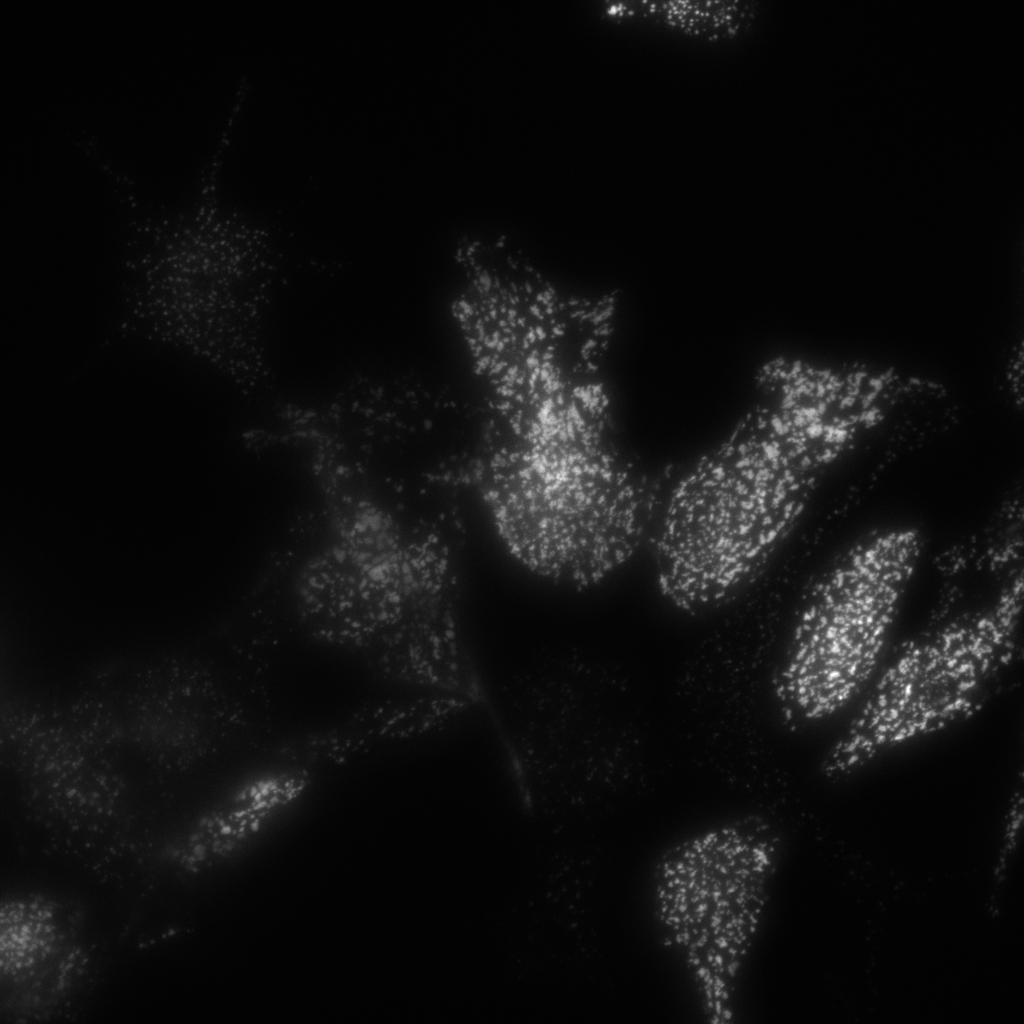 Colocalization analysis using Coloc2-help - Image Analysis - Image.sc Forum