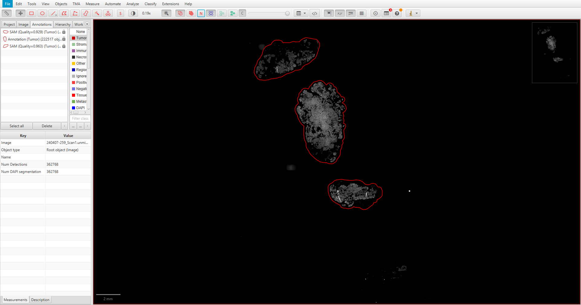 Problem with Cellpose segmentation with multiple annotations - Image Analysis - Image.sc Forum