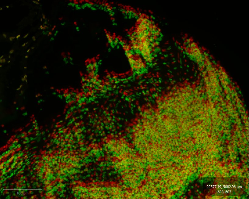 Ashlar for czi Zeiss file - Usage & Issues - Image.sc Forum