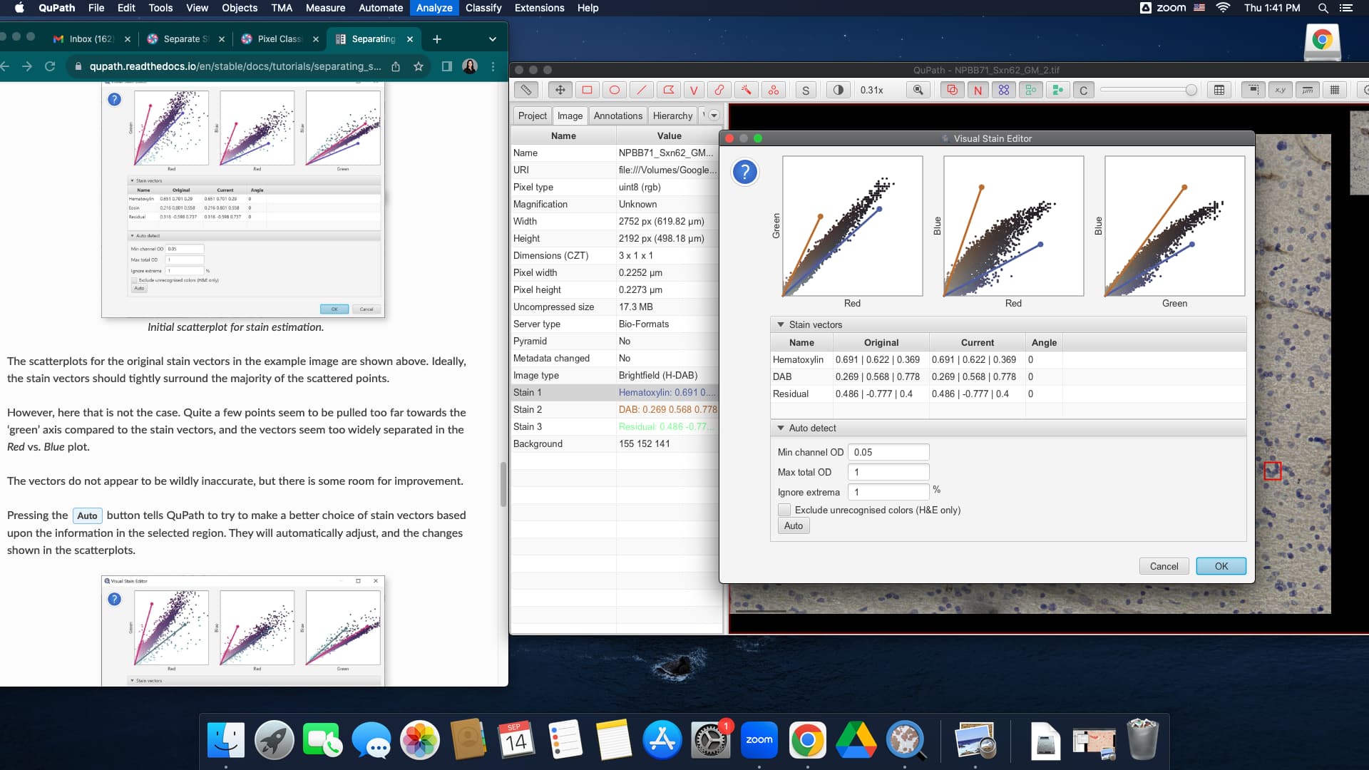 Pixel Classifier/Thresholder Not Picking Up Intensities? - Image Analysis - Image.sc Forum