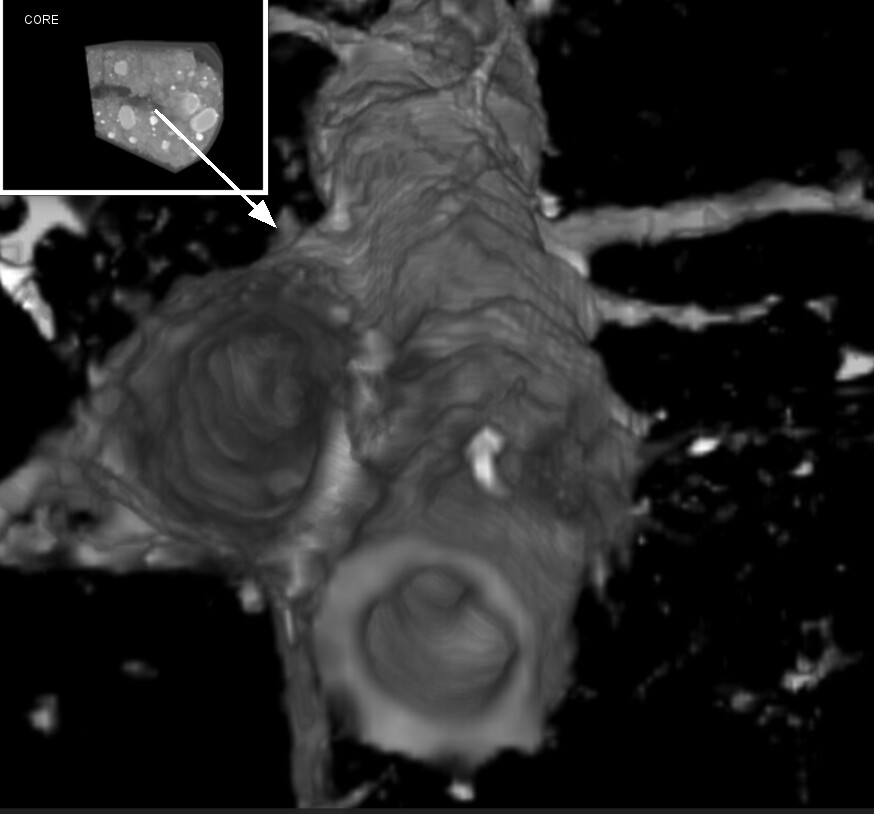 Segmentation of negative contrast cells - Image Analysis - Image.sc Forum