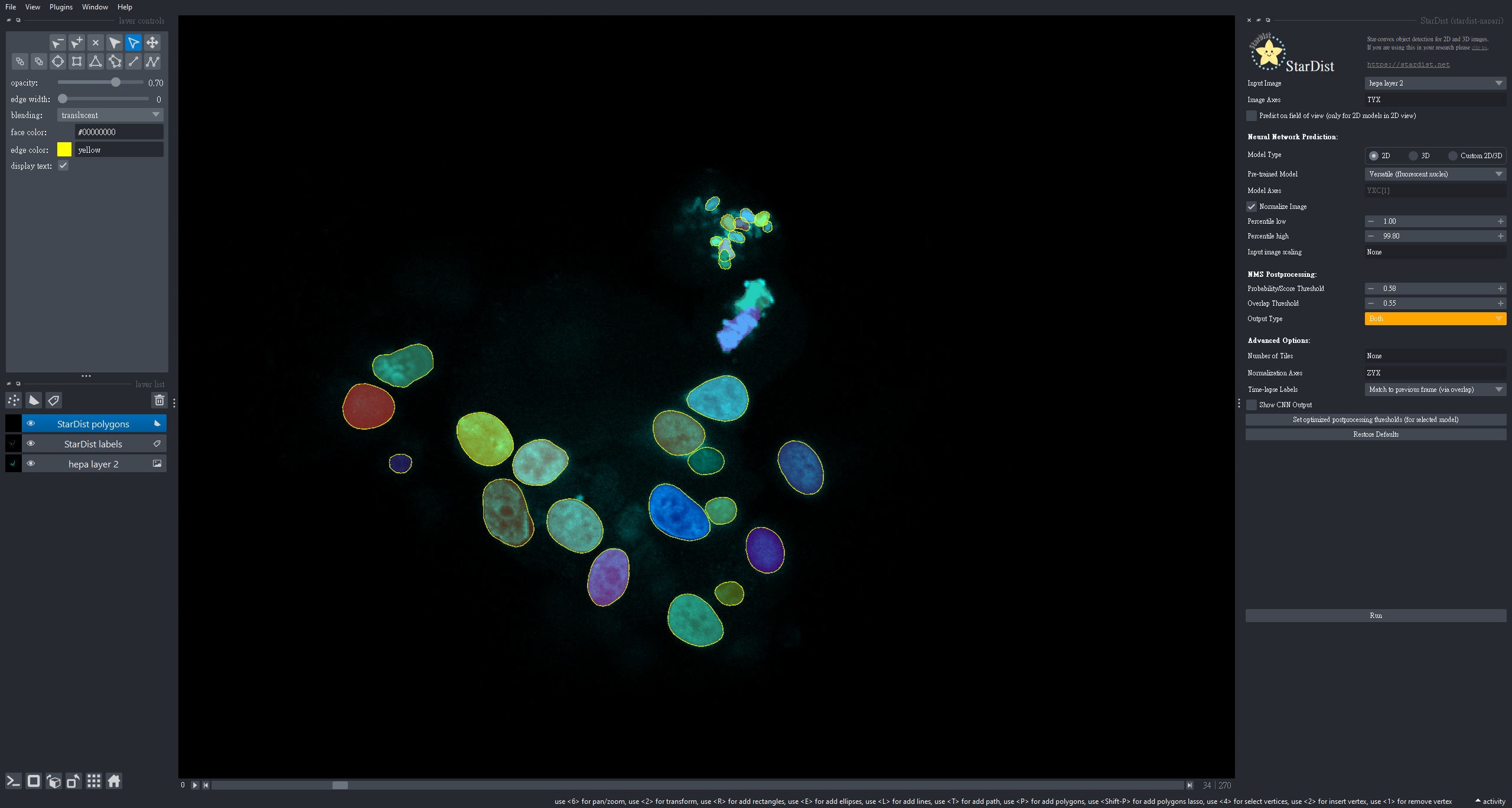 Training Stardist 3d Model Image Analysis Image Sc Forum