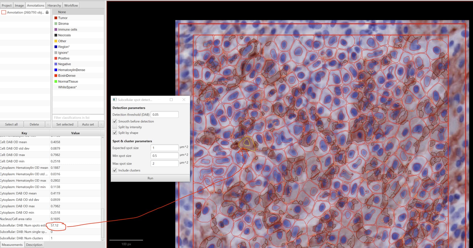 Positive cell detection - false positives - Image Analysis - Image.sc Forum