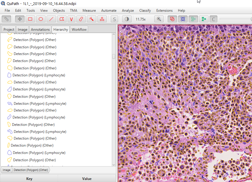 QuPath-Python Import/Export instance segmentation masks for binary classification - Image ...