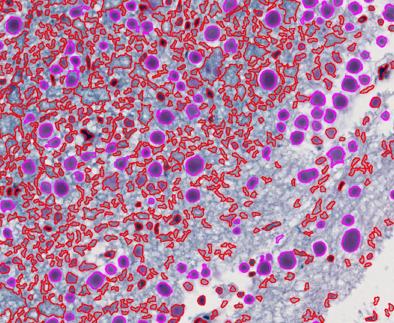 Optimization Of Cell Detection Parameters For Non Cellular Structures