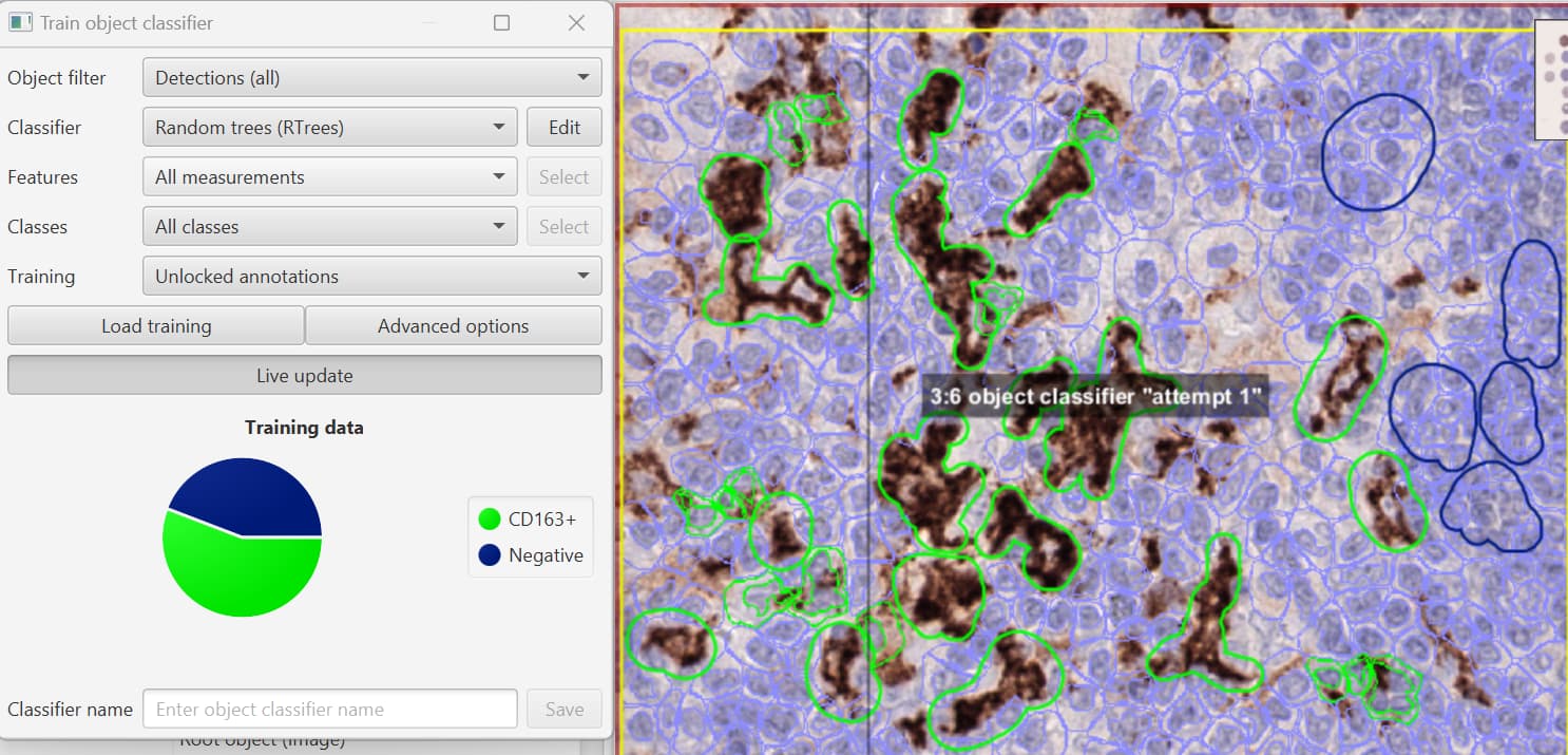Train object classifier for CD163+ macrophages - Usage & Issues - Image.sc Forum