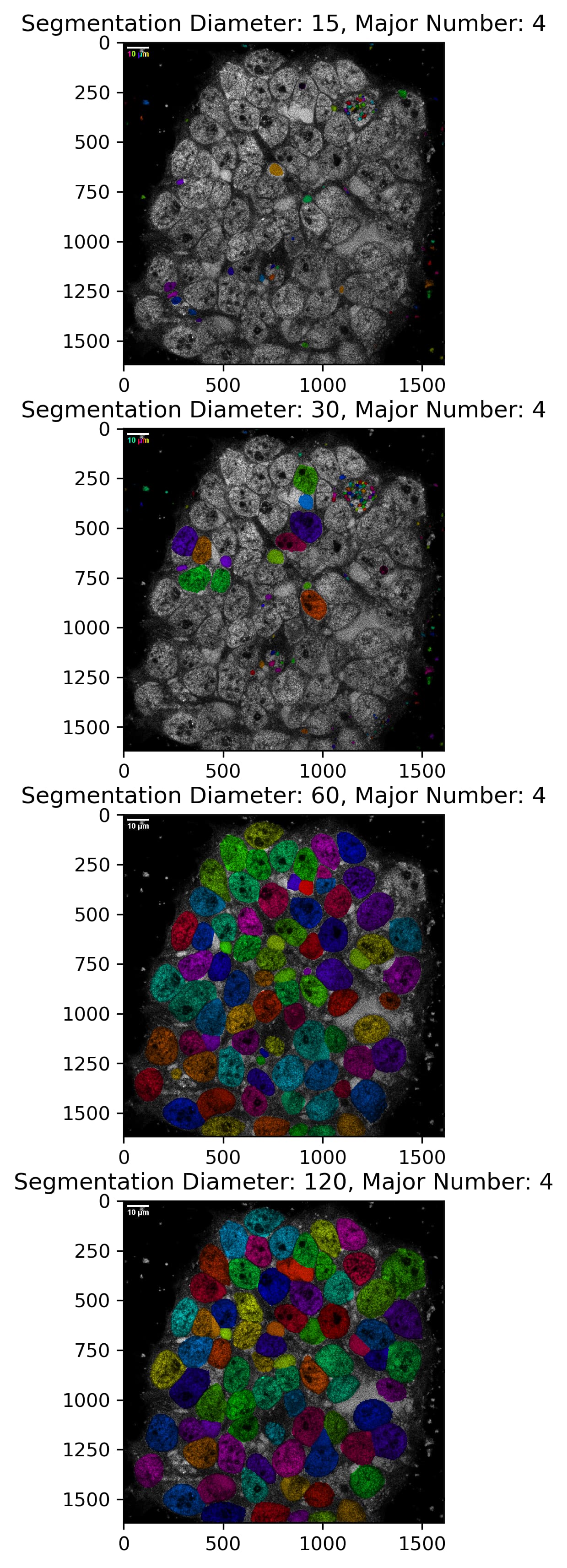 Segmenting Densely Packed Nuclei In 3d Image Analysis Imagesc Forum