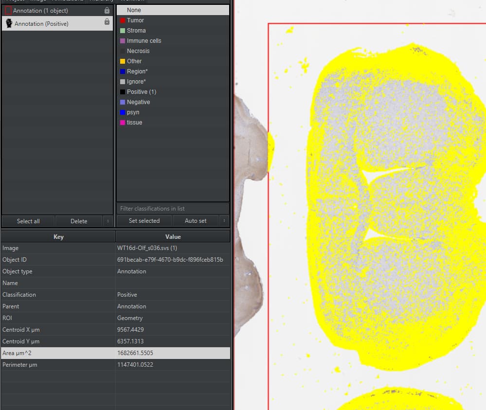 Creating summary area measurements - Image Analysis - Image.sc Forum