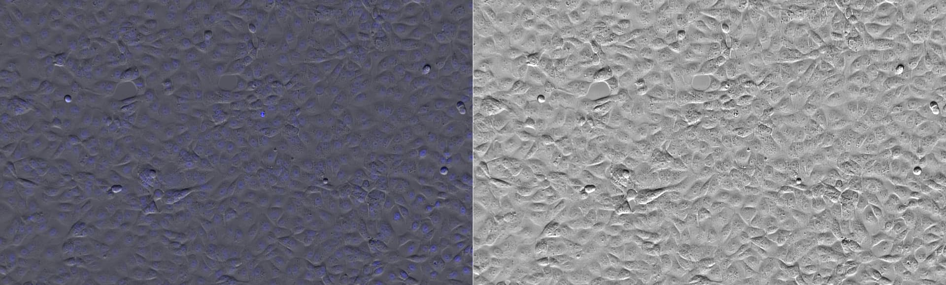 Segmenting cell image from CD7 microscope - Image Analysis - Image.sc Forum
