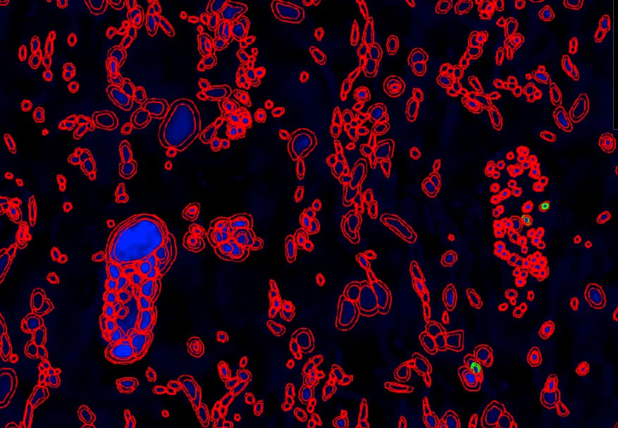 Seeking Advice forCell Segmentation in Multiplex IHC Using QuPath and StarDist - Image Analysis ...
