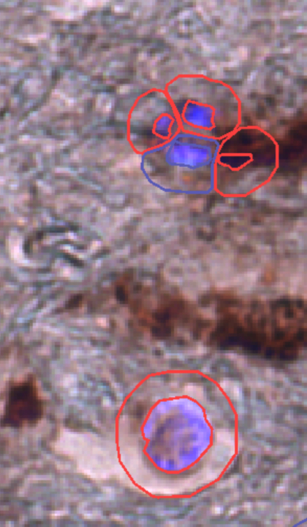 Cell detection with DAB, hematoxylin and DAPI - Image Analysis - Image ...