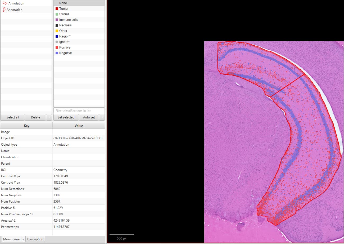 QuPath splitting ROI - Image Analysis - Image.sc Forum