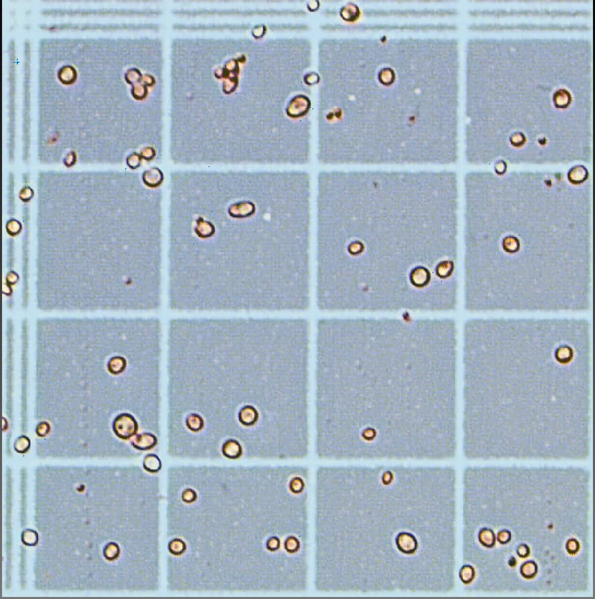 CellProfiler and hemocytometer - Image Analysis - Image.sc Forum