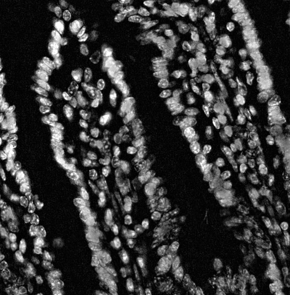 Dapi channel image adjustment/ cell segmentation - Image Analysis - Image.sc Forum