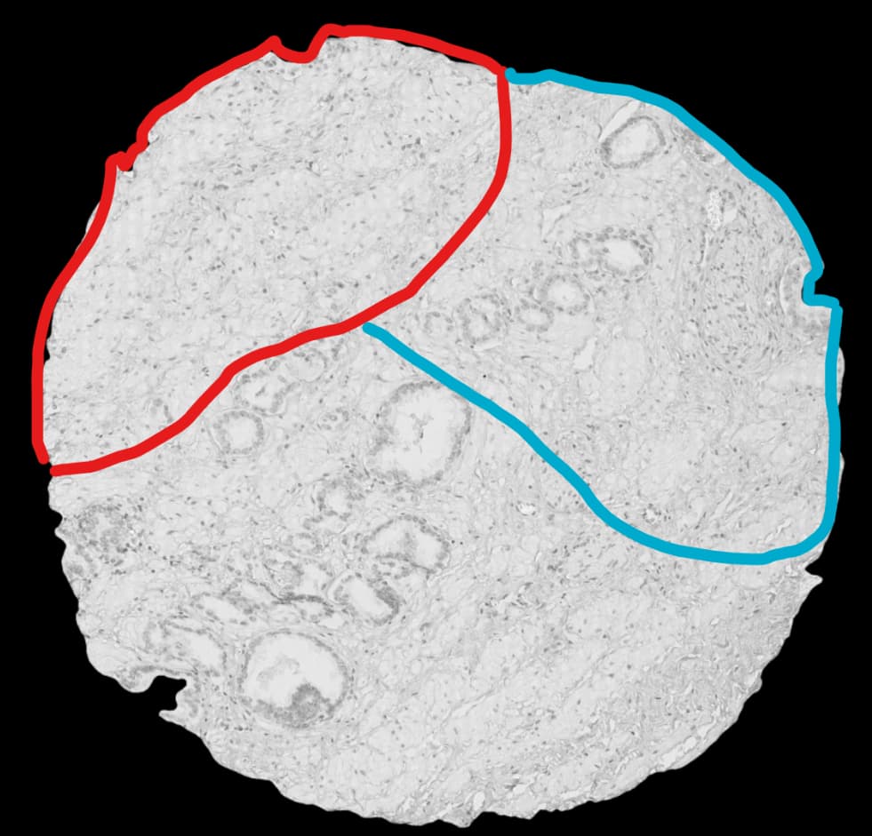 Creating a Multi-Region Mask in a Single File with ImageJ or CellProfiler - Image Analysis ...