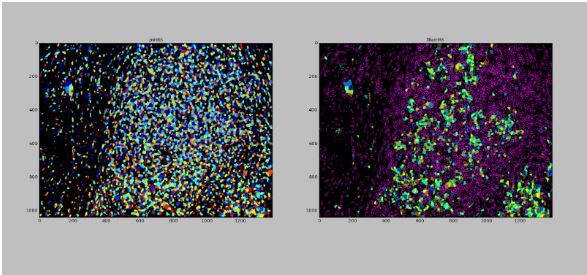 Tissue segmentation using CellProfiler! - Image Analysis - Image.sc Forum