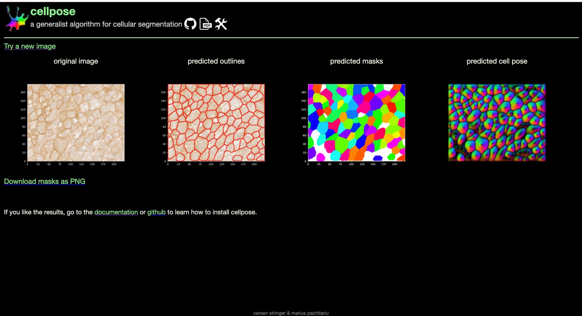 How to count DAB-positive cells detected by membrane staining in QuPath - Image Analysis - Image ...
