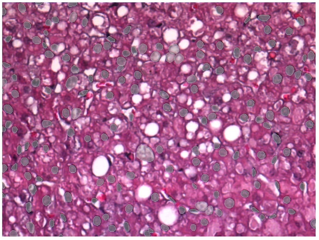 Enhancing and Identifying Nuclei (H&E stain) - Image Analysis - Image.sc Forum