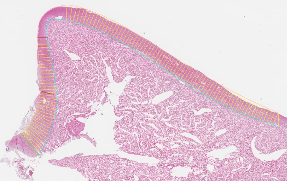 ImageJ macro to measure distance between two user-drawn lines/edges ...