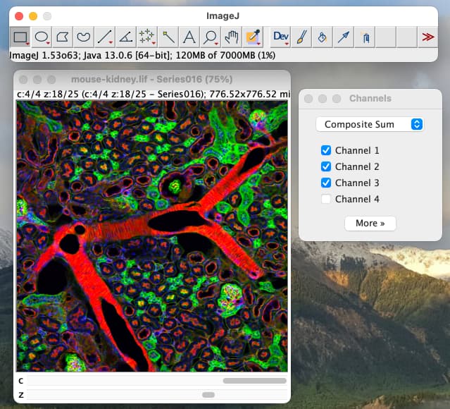 Drag and drop .lif doesn't trigger Bio-Formats dialog in last ImageJ versions - Usage & Issues ...