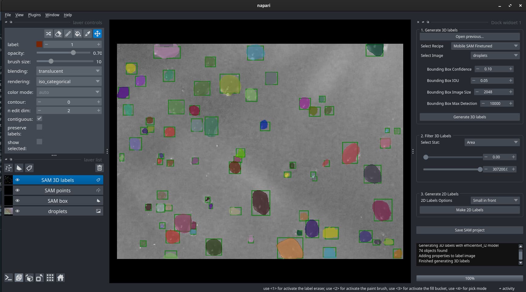 Help needed on image analysis using imagej - Image Analysis - Image.sc Forum