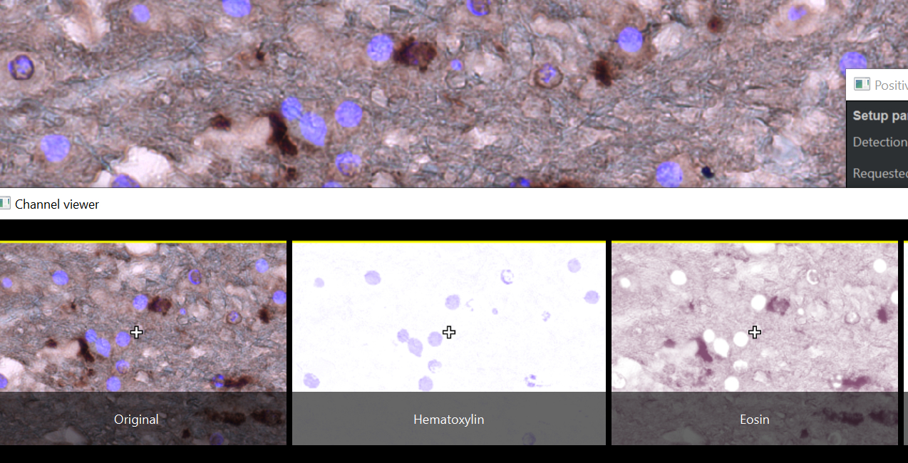 Cell detection with DAB, hematoxylin and DAPI - Image Analysis - Image.sc Forum