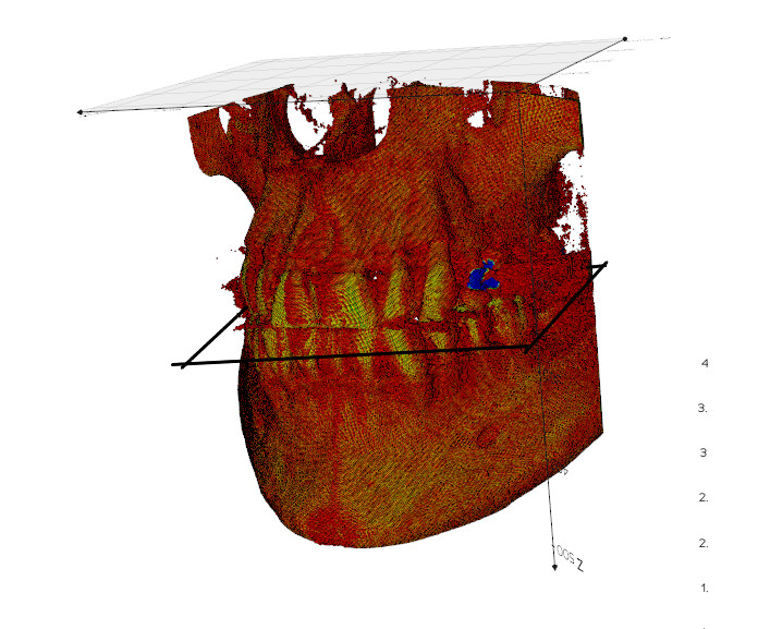 How to make the slicePlane method take the whole slice (similarly to ...
