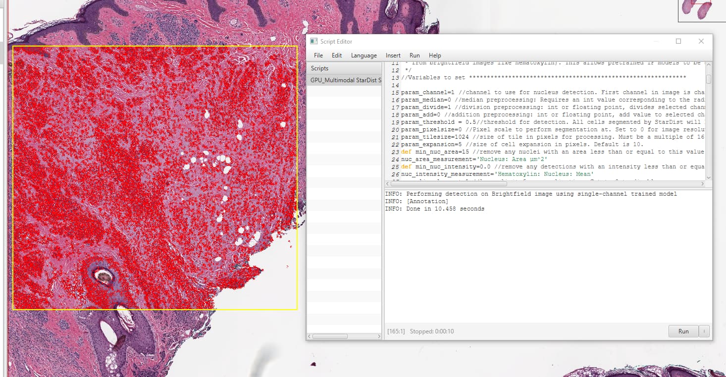 Qupath Stardist Gpu Error In Usage And Issues Image Sc Forum