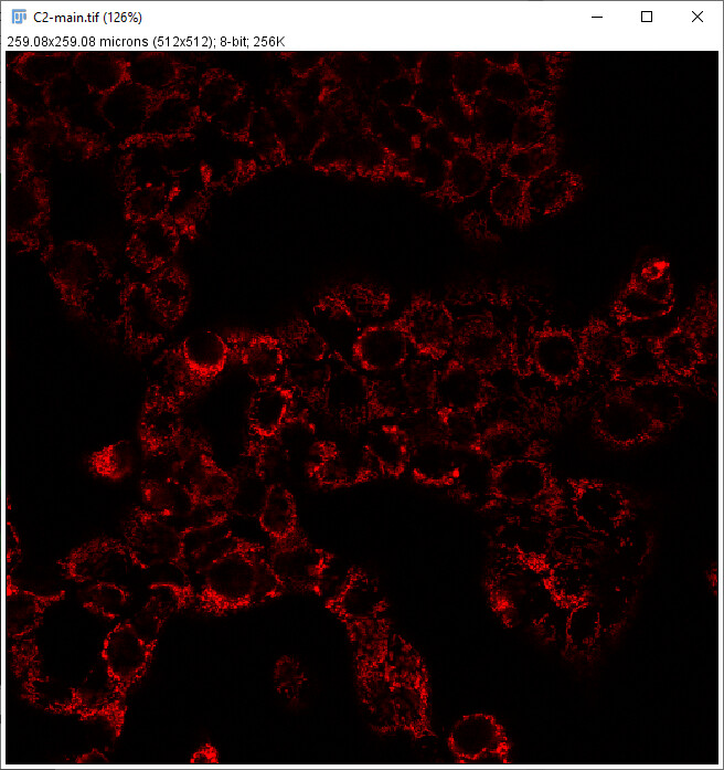 JaCoP vs Coloc 2 very different output values - Usage & Issues - Image.sc Forum