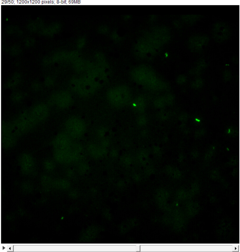 Automating Trackmate Analysis in Fiji - Image Analysis - Image.sc Forum