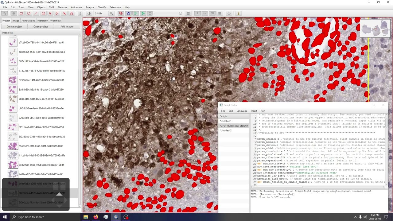 HDAB Cell Detection Using StarDist - Image Analysis - Image.sc Forum HDAB Cell Detection Using StarDist - Image Analysis - Image.sc Forum