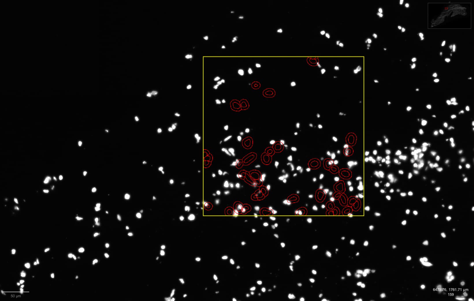 ᴗ• Qupath Scripting 2 Using Clupath And Ij To Show Image With Additional Local Threshold