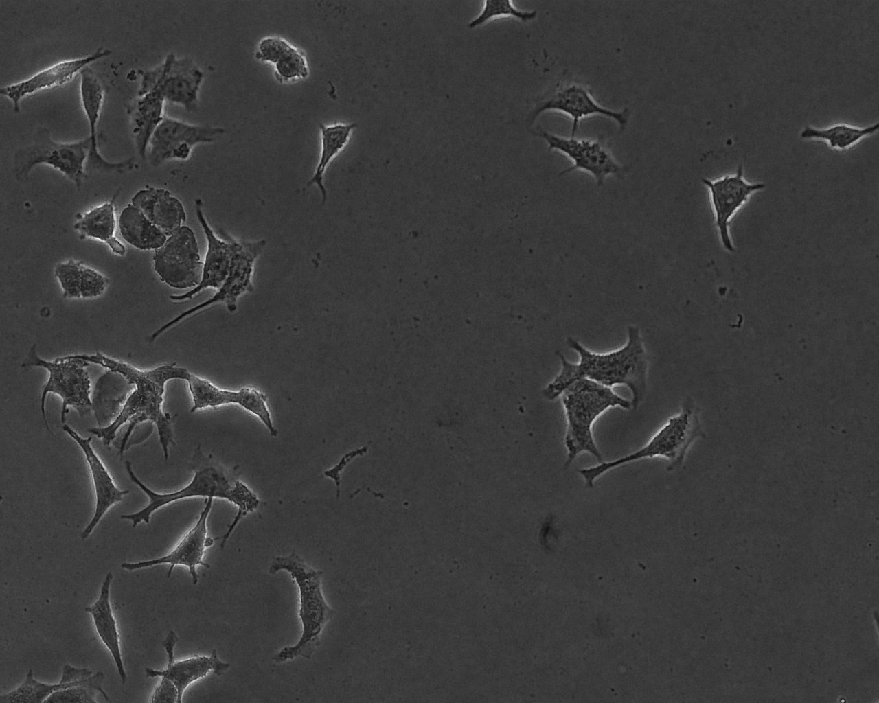 How to analyze the particle in imageJ using 2 different channel - Image Analysis - Image.sc Forum