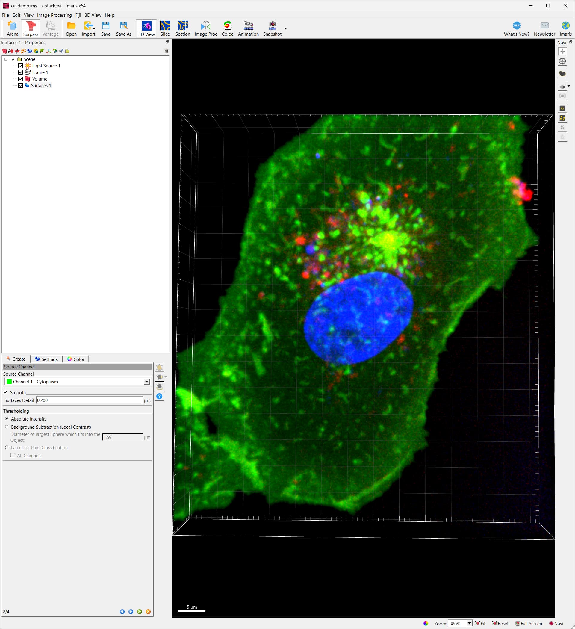 Color treshold/Colocalisation in Imaris - newbie question - Image ...