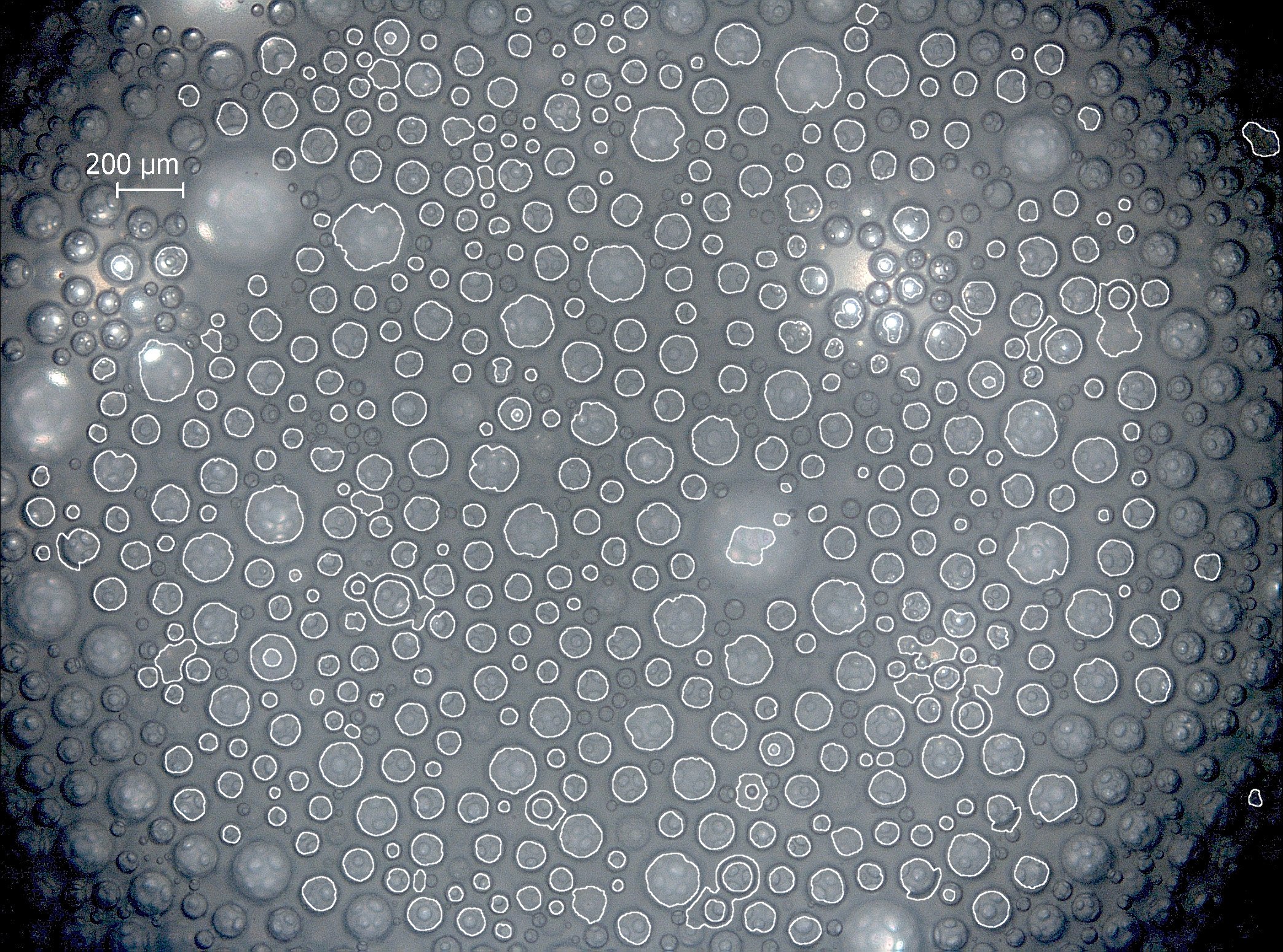 Foam bubble size distribution - Image Analysis - Image.sc Forum