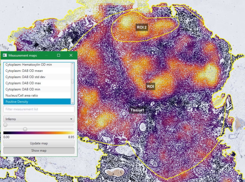 Cell Density Map - Image Analysis - Image.sc Forum